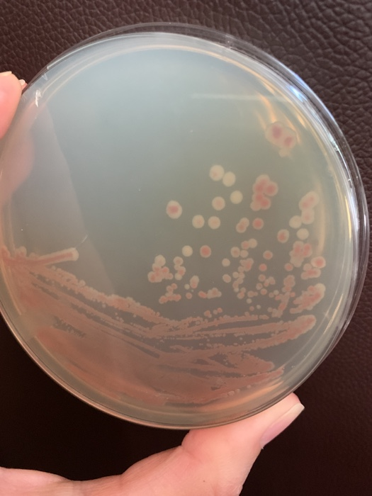 Solved Did you obtain isolated colonies of both organisms? | Chegg.com