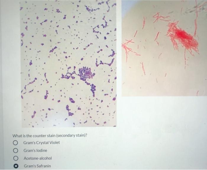 Solved What is the primary stain? Gram's Safranin Gram's | Chegg.com