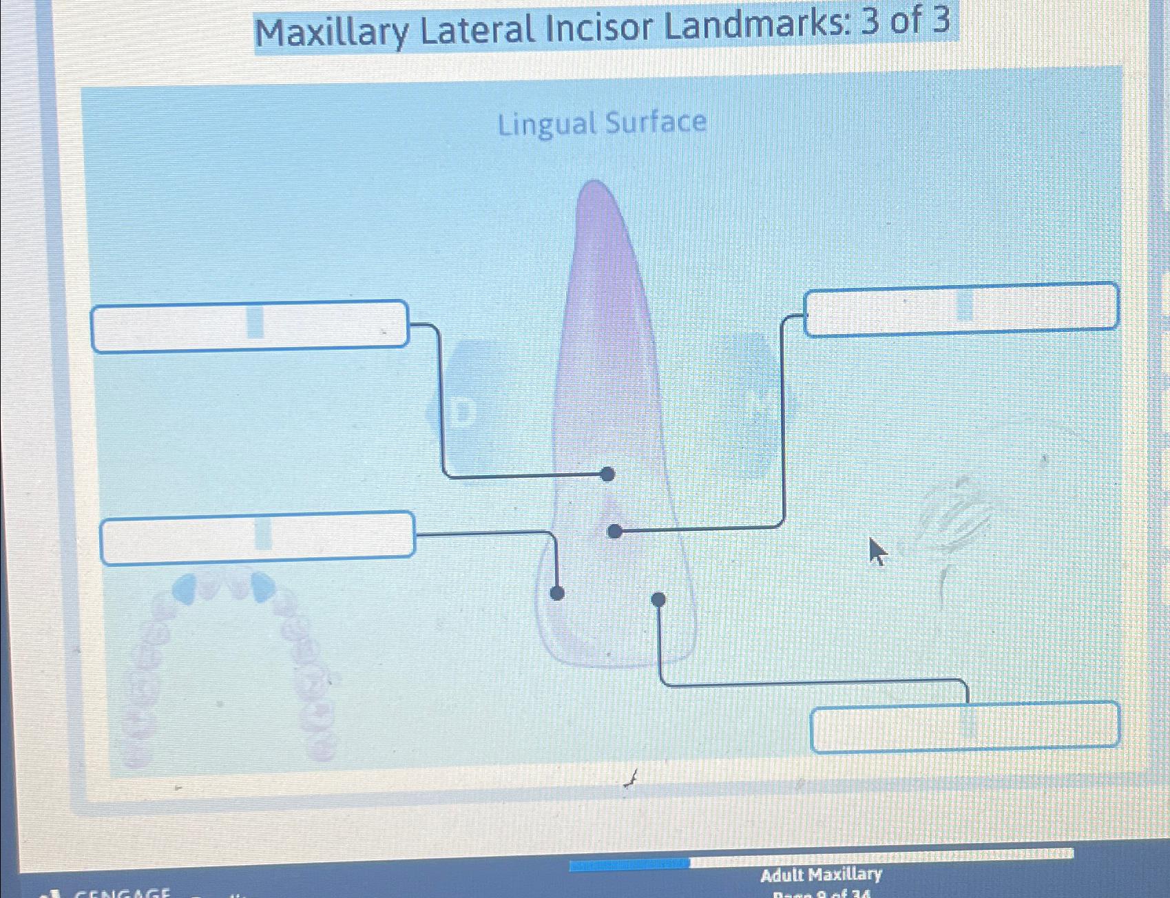 Solved Maxillary Lateral Incisor Landmarks: 3 ﻿of 3Lingual | Chegg.com