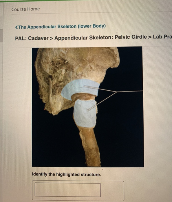 Solved Course Home Appendicular Skeleton: Pelvic Girdle > | Chegg.com