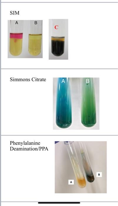 Solved А Exercise 30 Results Starch Agar Plate Casein Agar | Chegg.com