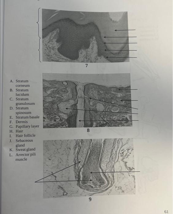 Solved A. Stratum corneum B. Stratum lucidum C. Stratum | Chegg.com