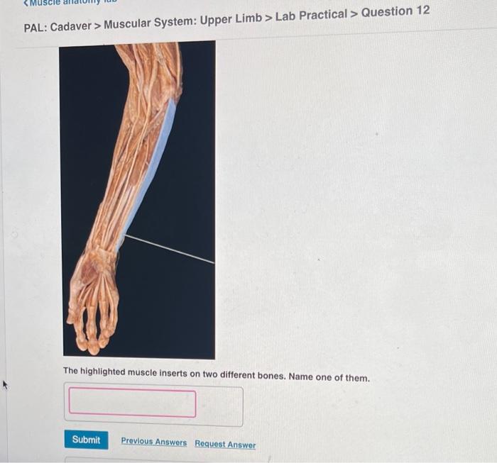 Solved The highlighted muscle inserts on two different | Chegg.com