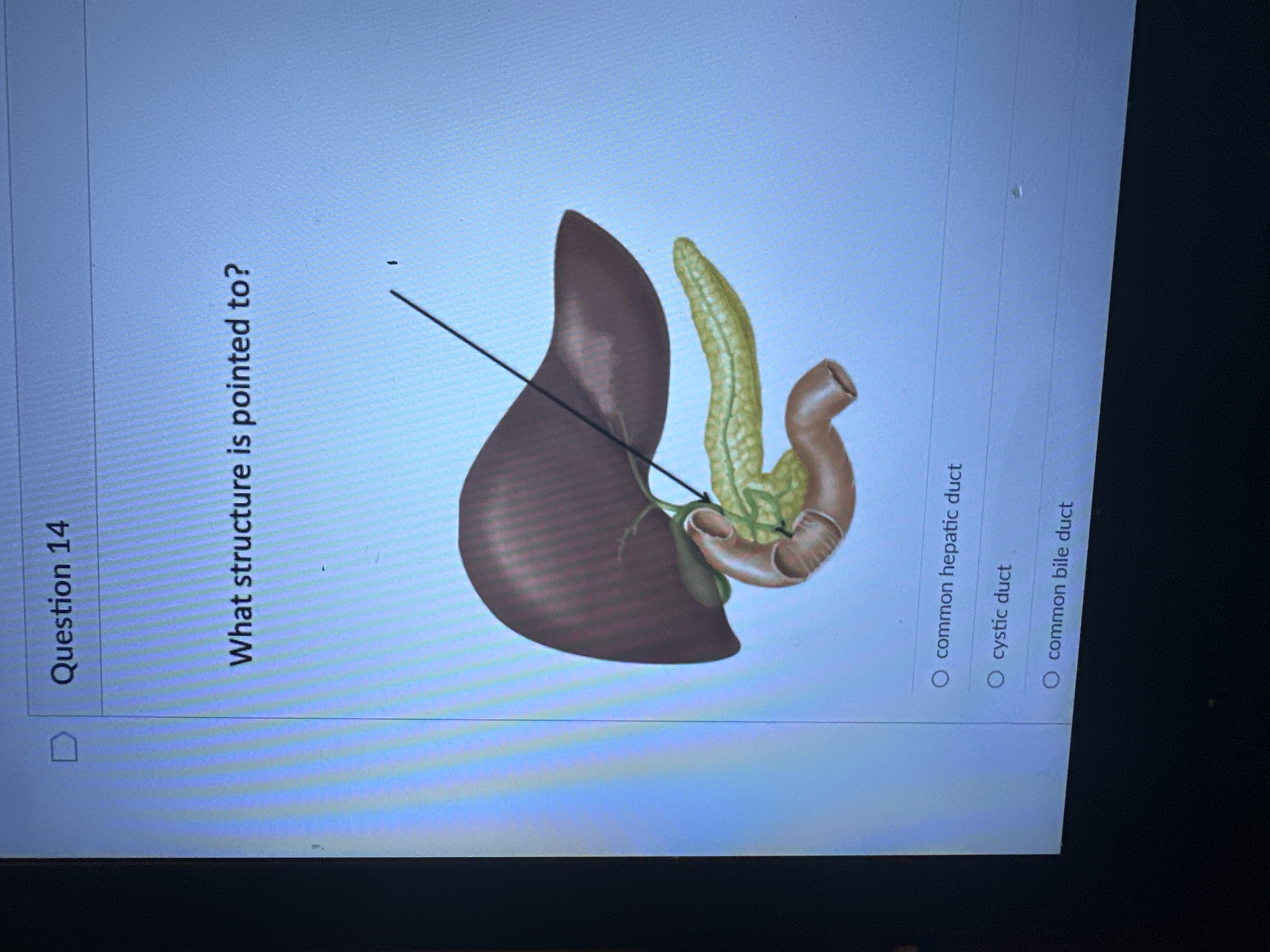 Solved whT structurerectumQuestion 12Chemical digestion | Chegg.com