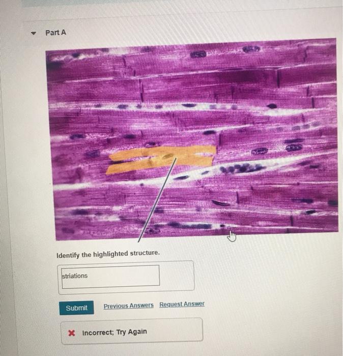 Solved Part A Identify the highlighted structure. striations | Chegg.com