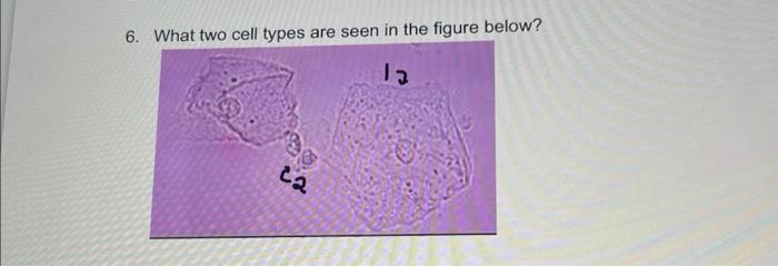 Solved 6. What two cell types are seen in the figure below? | Chegg.com