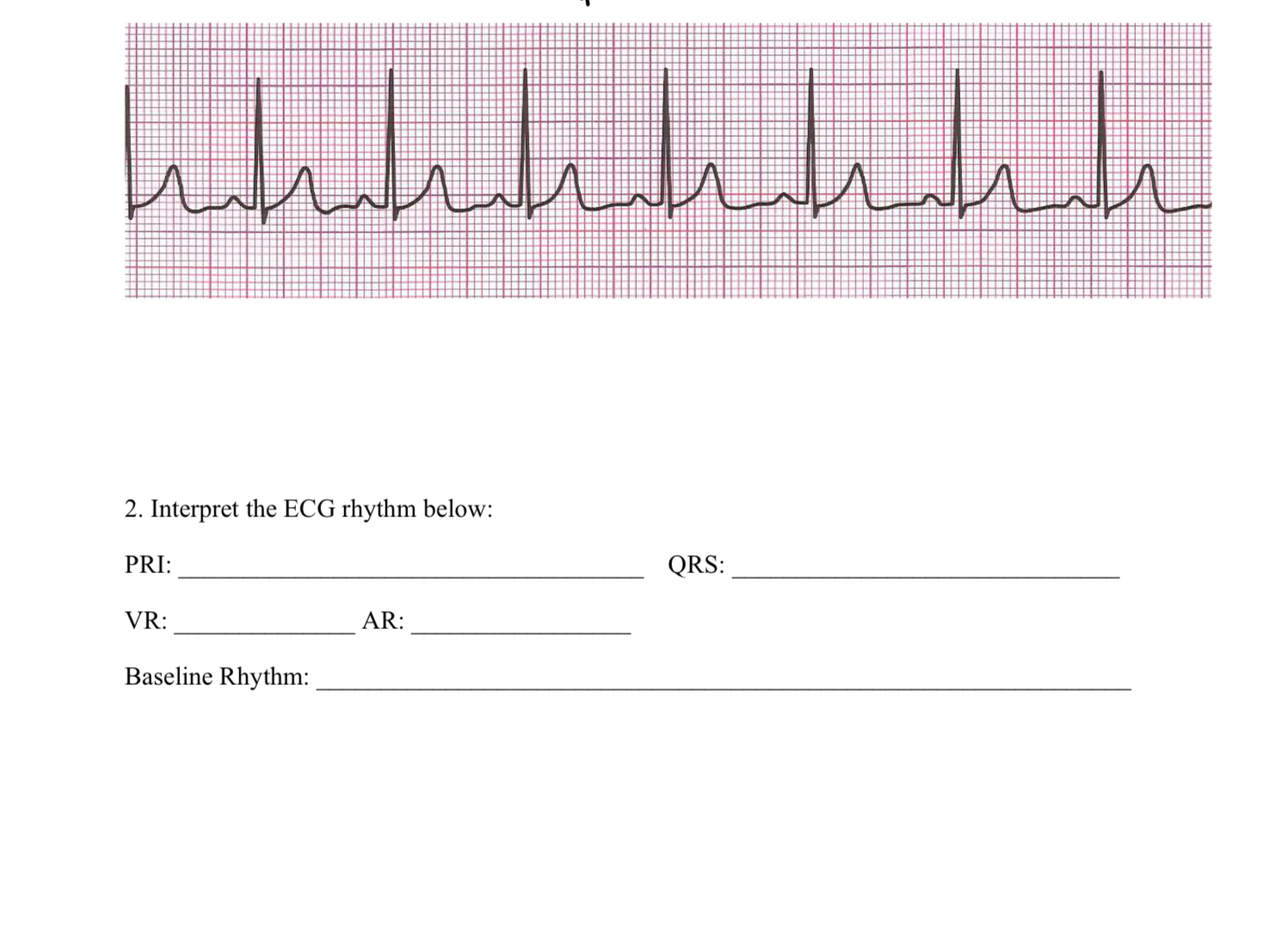 Solved Interpret the ECG rhythm below:PRI: | Chegg.com