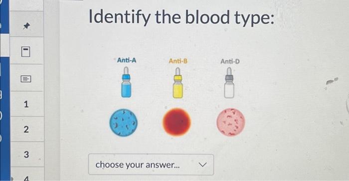 Solved 1 2 3 Identify the blood type: Anti-A Anti-B choose | Chegg.com
