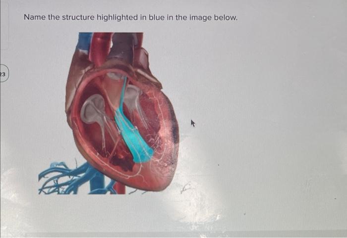 Solved Name the structure highlighted in blue in the image | Chegg.com