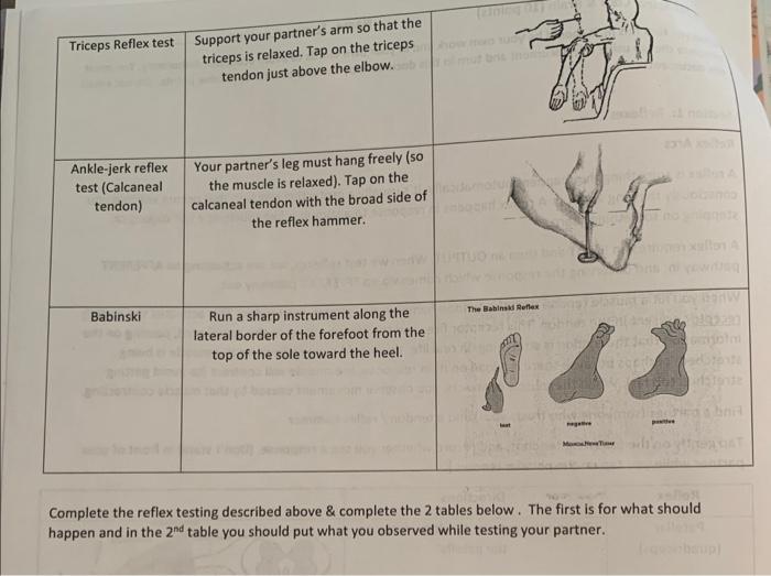 Solved BIOL2451-Spinal Cord & Brain Section 1: Reflex | Chegg.com