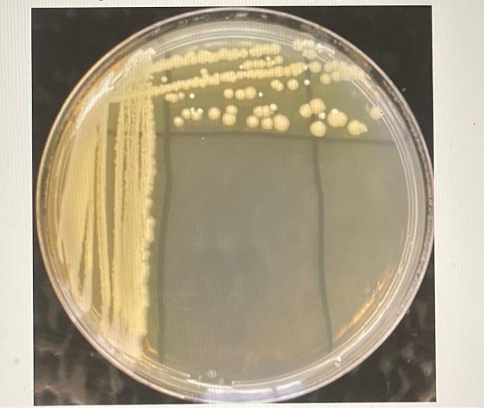 Proteus Vulgaris Gram Stain 1000x