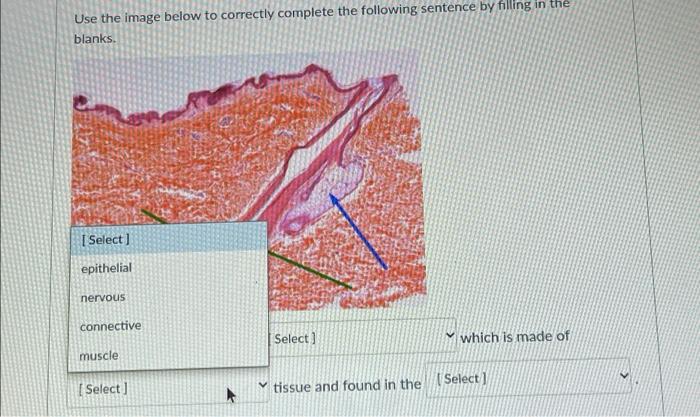 Solved Use the image below to correctly complete the | Chegg.com