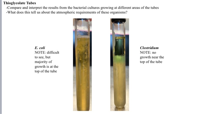 Solved Thioglycolate Tubes -Compare and interpret the | Chegg.com