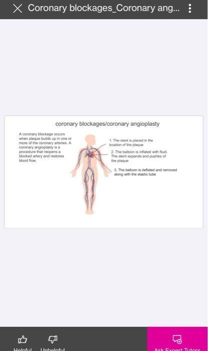 Solved You will be creating annotated diagrams for the | Chegg.com