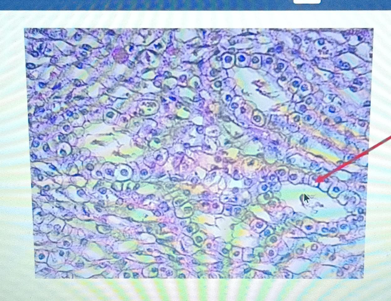 Solved tissue? | Chegg.com