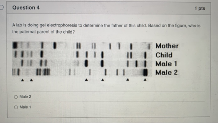 Solved Question 4 1 pts A lab is doing gel electrophoresis | Chegg.com