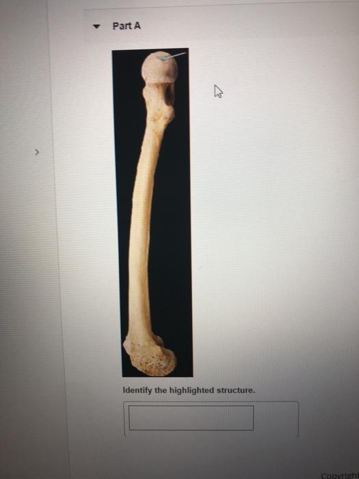 Solved Part A Identify the highlighted bone. Submit Request | Chegg.com