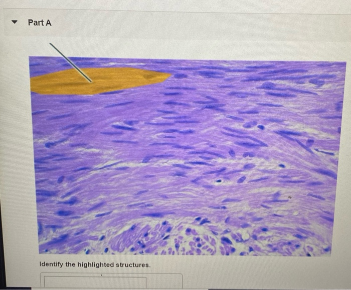 Solved Part A Identify the highlighted structure. perimesium | Chegg.com