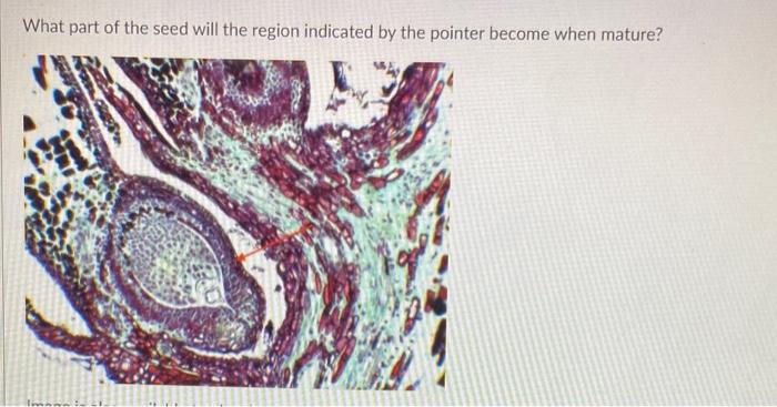 Solved What part of the seed will the region indicated by | Chegg.com