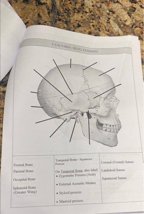 Solved 4 CALVARIA-SKULL EXTERNAL Temporal Bone - Squamous | Chegg.com