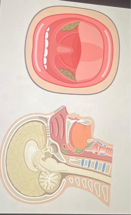 Solved Tonsils labeling | Chegg.com