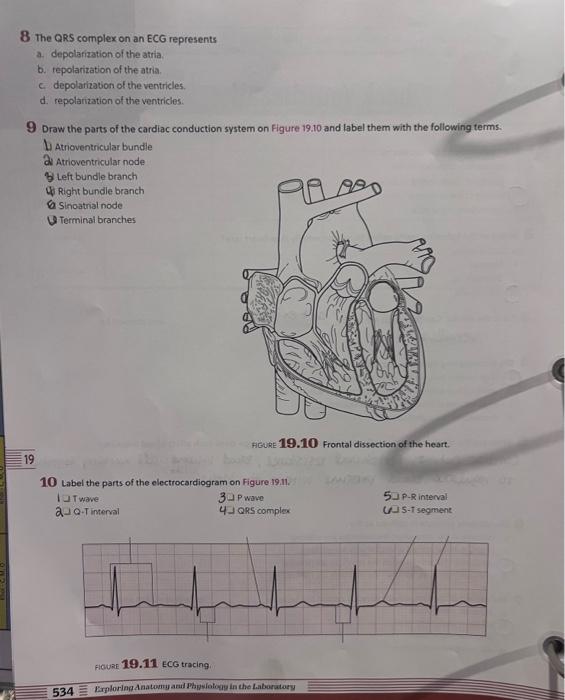 8 The QRS complex on an ECG represents a. | Chegg.com