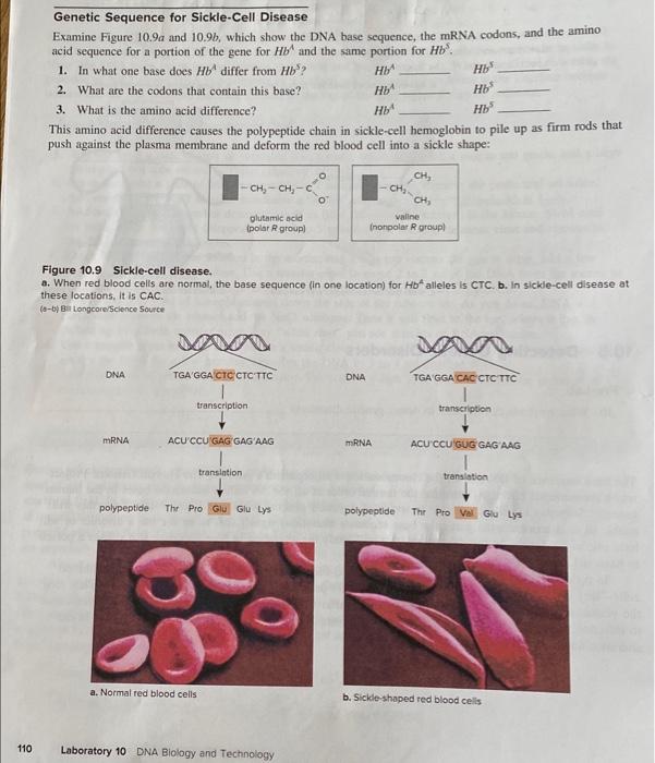 Solved Genetic Sequence for Sickle-Cell Disease Examine | Chegg.com
