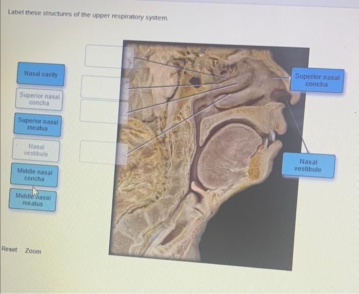 Solved Label these structures of the upper respiratory | Chegg.com