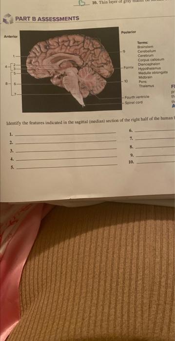 Solved PART B ASSESSMENTS Terms: Arainslern Corebelum | Chegg.com