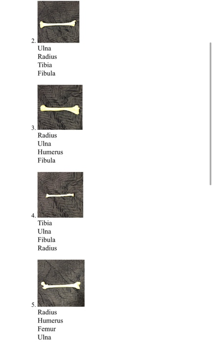 Solved Ulna Radius Tibia Fibula 3. Radius Ulna Humerus | Chegg.com Solved Ulna Radius Tibia Fibula 3. Radius Ulna Humerus | Chegg.com