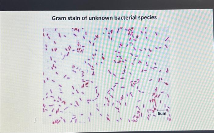 Solved Gram stain of unknown bacterial speciesAmylose test | Chegg.com