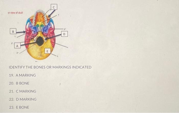 Solved IDENTIFY THE BONES OR MARKINGS INDICATED 19. AMARKING | Chegg.com