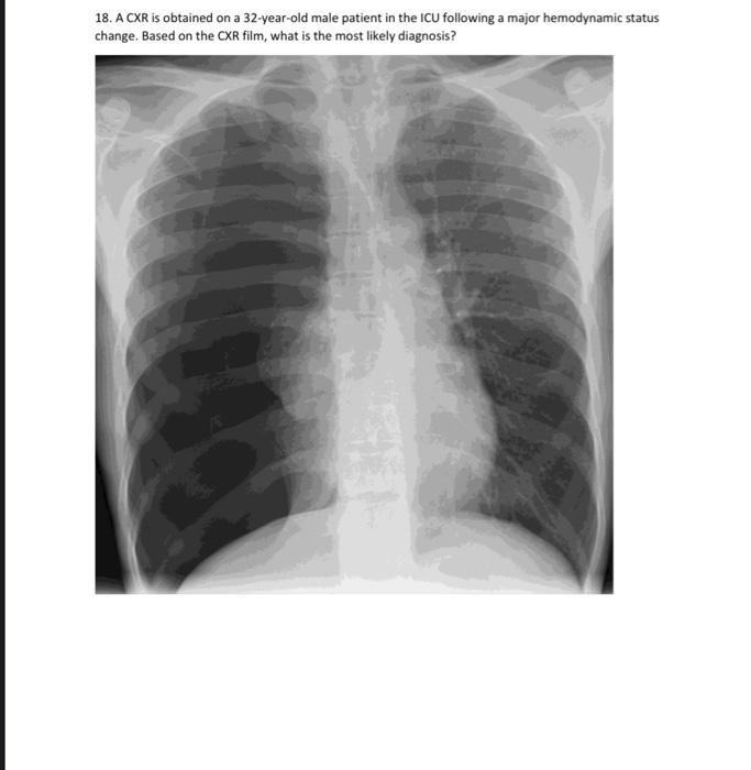 Solved 18. A CXR is obtained on a 32-year-old male patient | Chegg.com