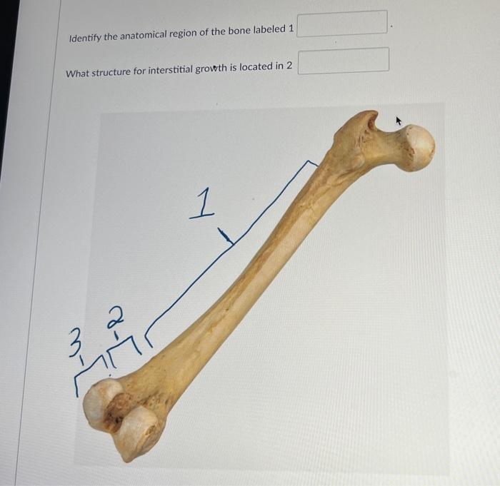 Solved Identify the anatomical region of the bone labeled 1 | Chegg.com