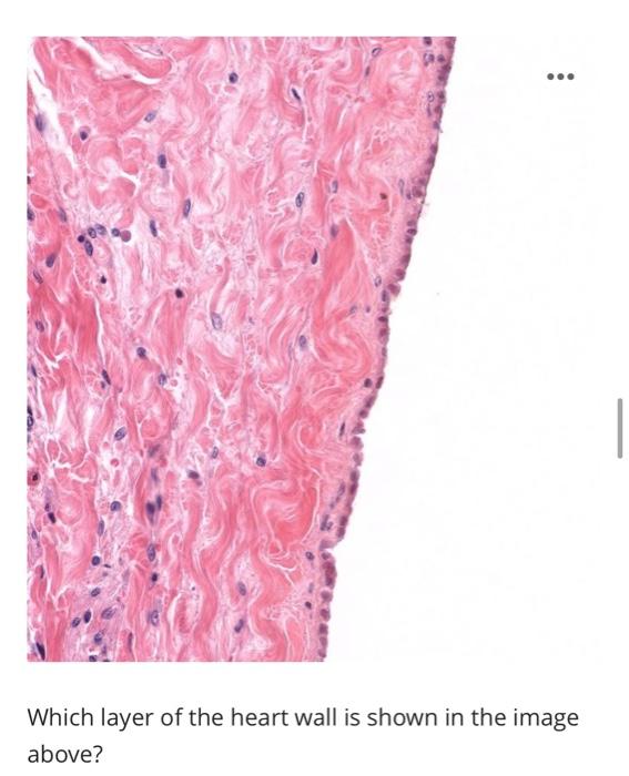 Solved A. The external elastic lamina B. The tunica mediaC. | Chegg.com