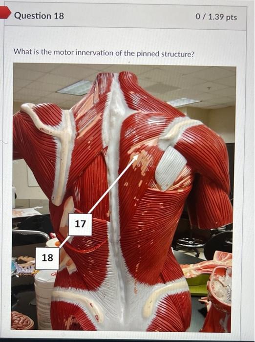 Solved Name the pinned structure.Rhomboid Minor Iliocostalis | Chegg.com