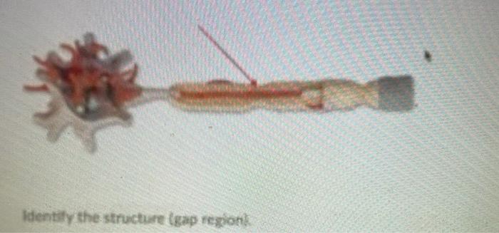 Solved Identify the structure igap region | Chegg.com