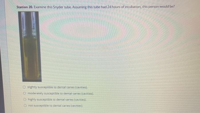 Solved Station 20. Examine this Snyder tube Assuming this | Chegg.com