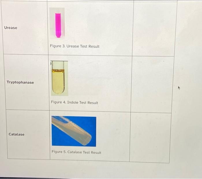 Solved 3. Interpret the following test results in Table 2: | Chegg.com
