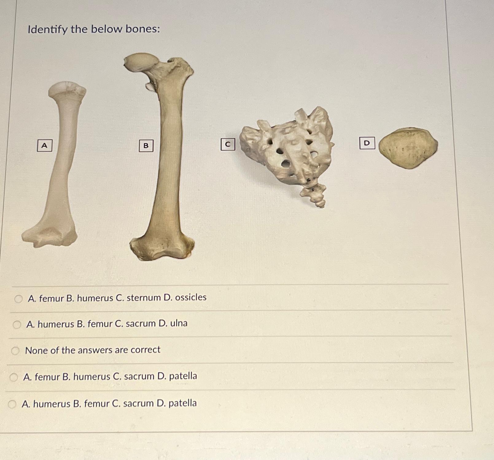 Solved Identify the below bones:A. ﻿femur B. ﻿humerus C. | Chegg.com