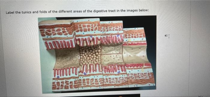 Solved Label the tunics and folds of the different areas of | Chegg.com