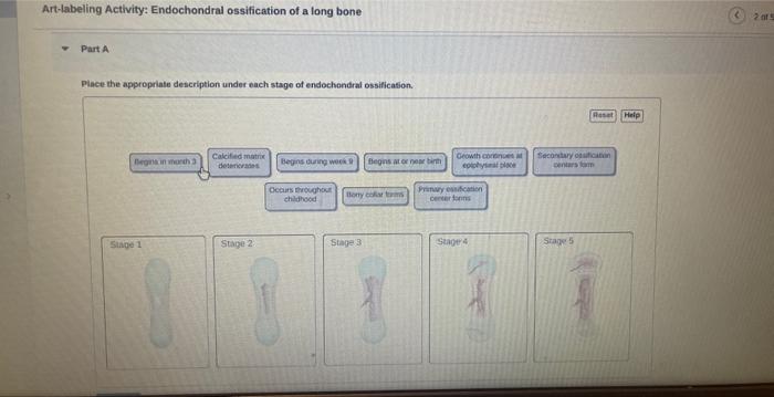 Art-labeling Activity: Endochondral ossification of a | Chegg.com