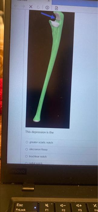 Solved X E This projection is the acromion O xiphoid process | Chegg.com