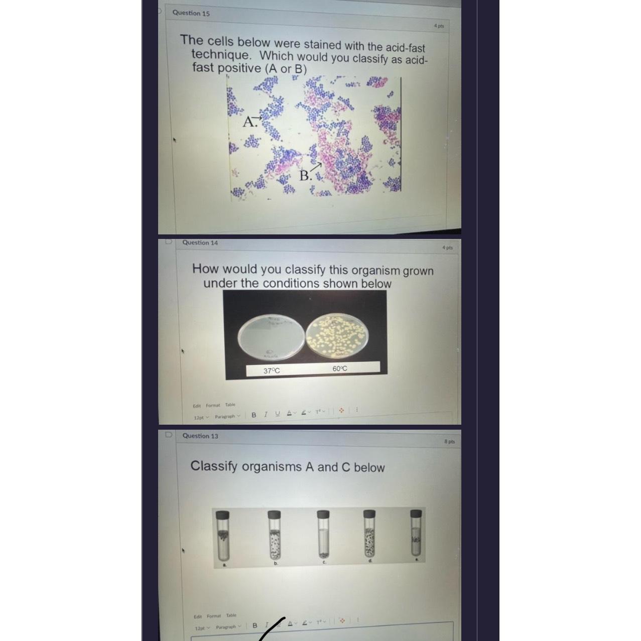 Solved Question 15The cells below were stained with the | Chegg.com