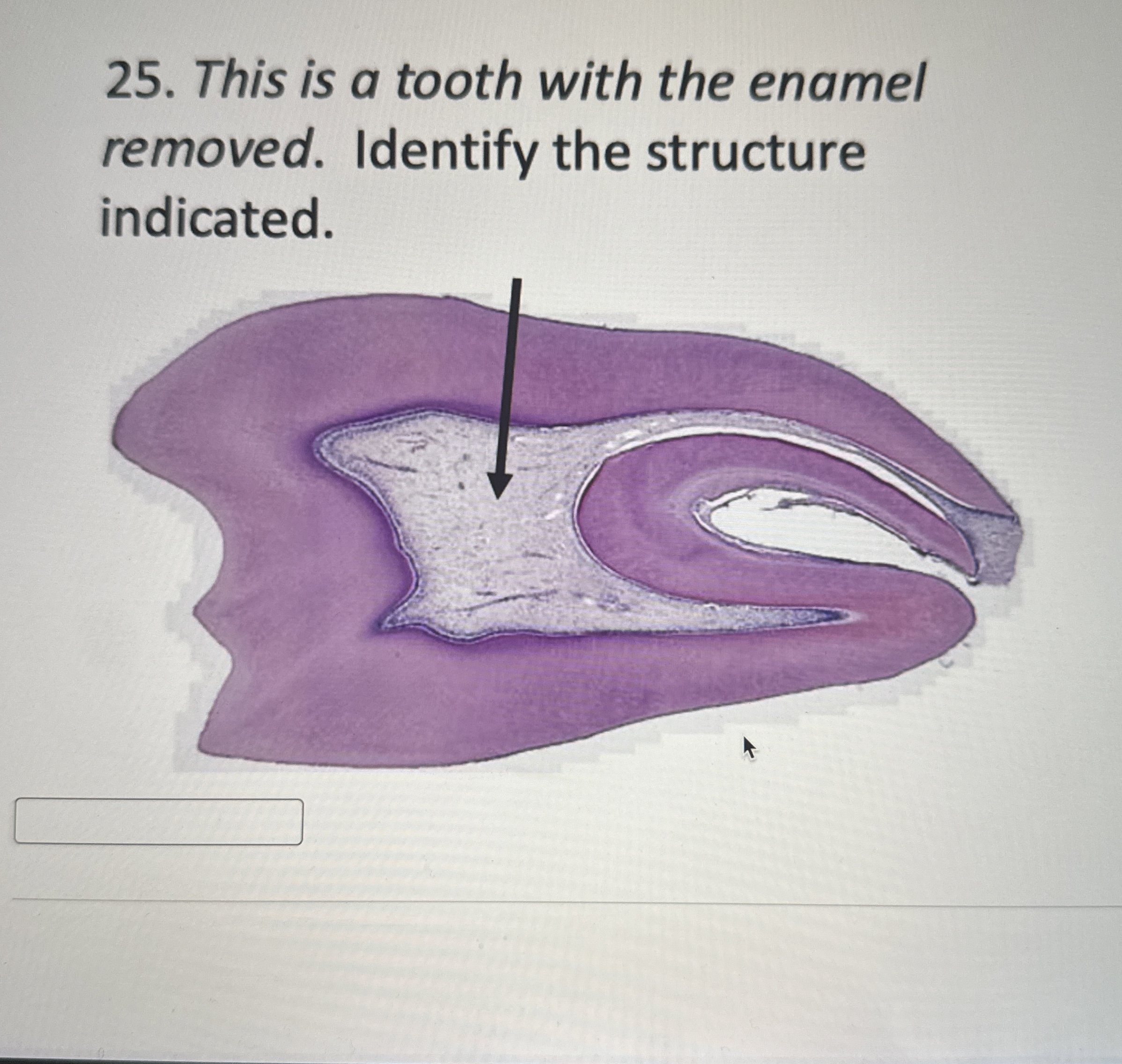 Solved This is a tooth with the enamel removed. Identify the | Chegg.com