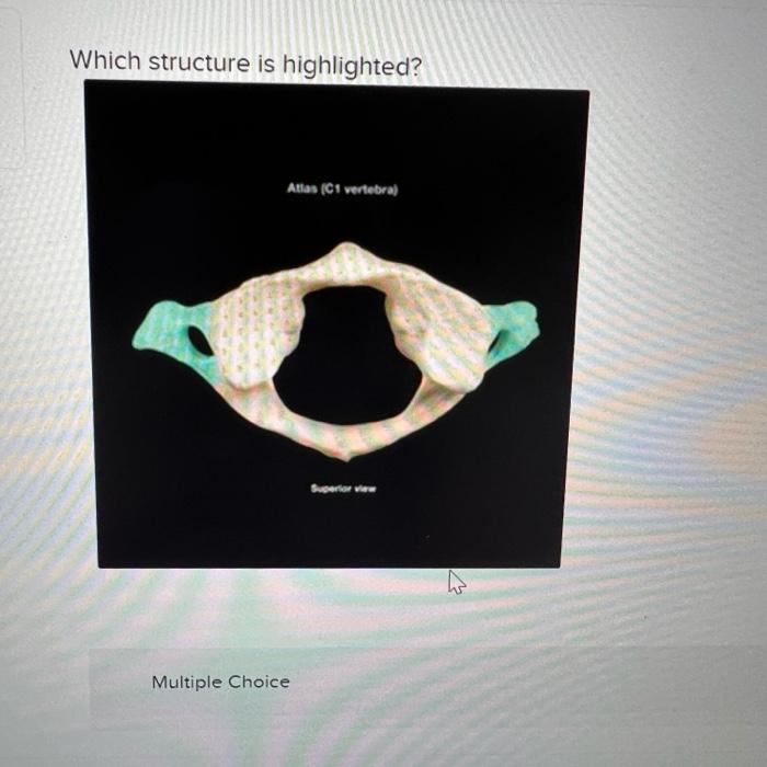 Solved Which structure is highlighted? body spinous process | Chegg.com