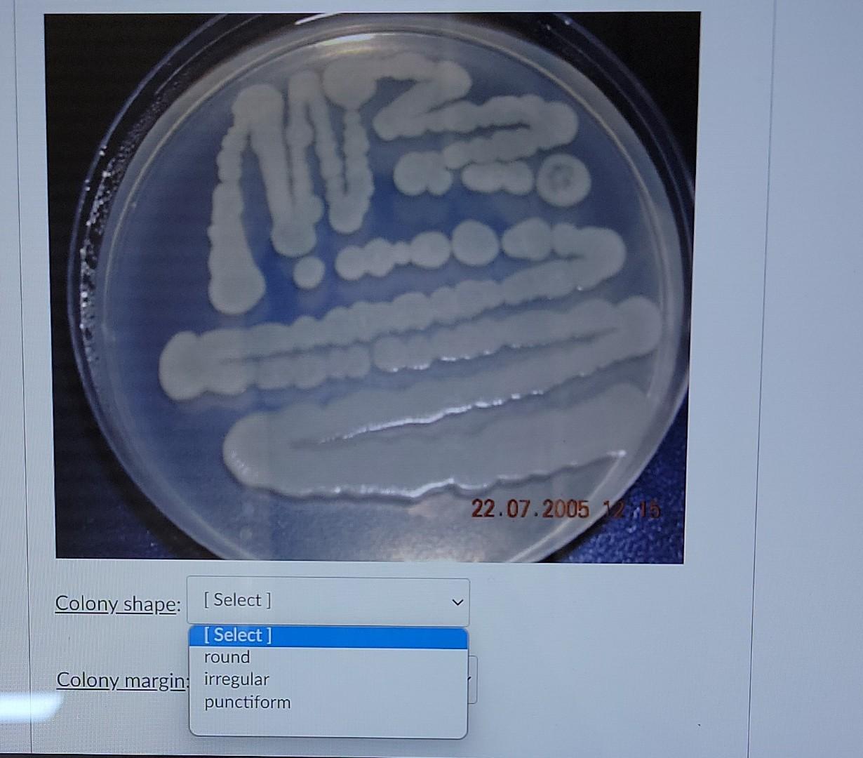 Solved CO October 22.07.2005 Colony shape: [Select ] [ | Chegg.com