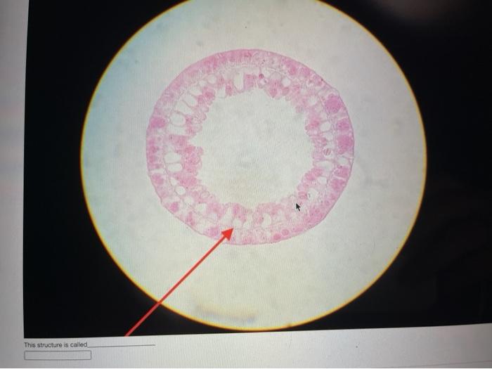 Solved This structure is called This structure is called | Chegg.com