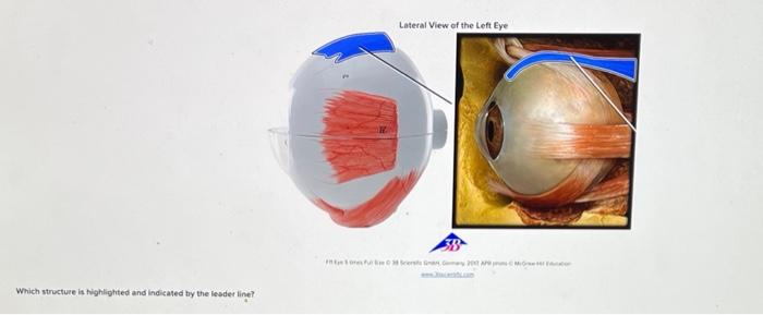Solved Which structure is highlighted and indicated by the | Chegg.com