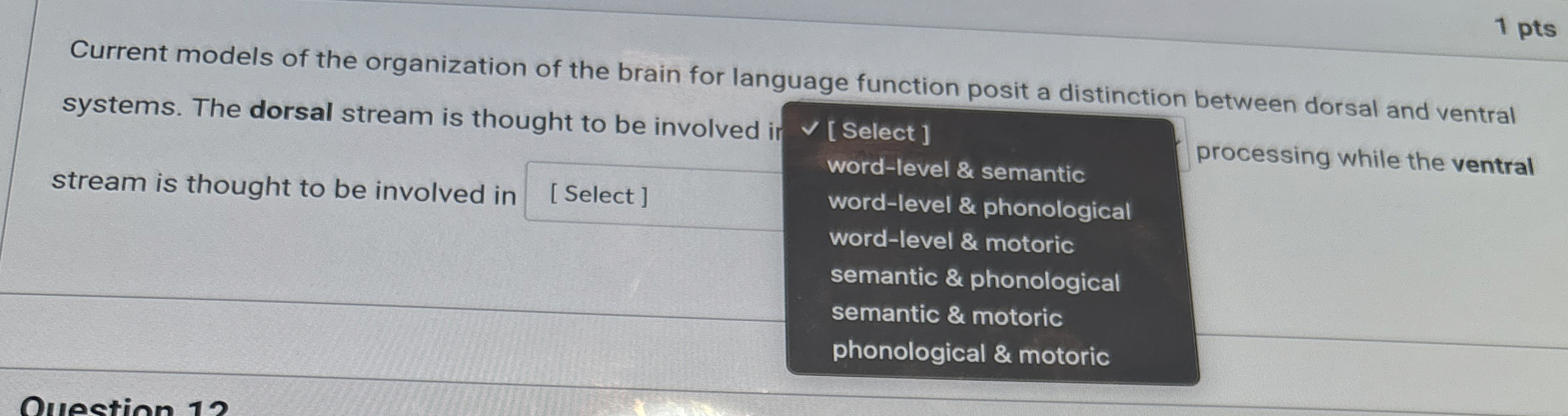 Solved 1 ﻿ptsCurrent models of the organization of the brain | Chegg.com